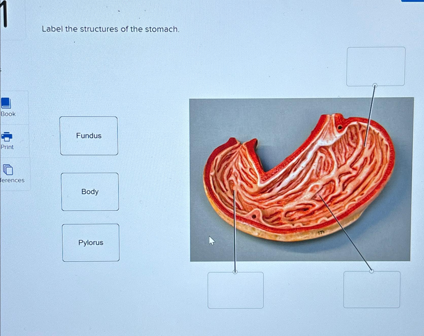 Solved Label the structures of the stomach. | Chegg.com Solved Label the structures of the stomach. | Chegg.com