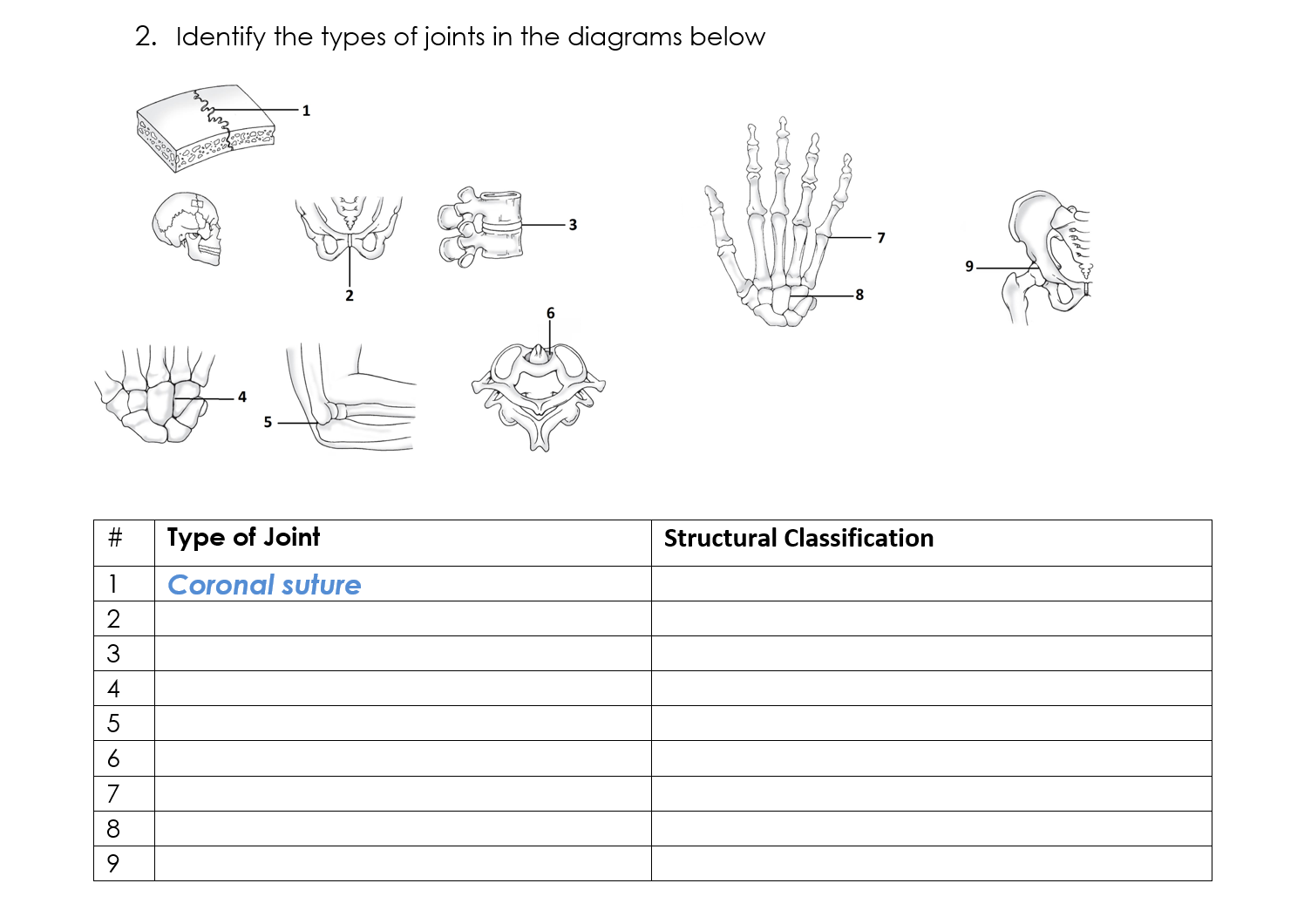Solved Identify the types of joints in the diagrams below | Chegg.com