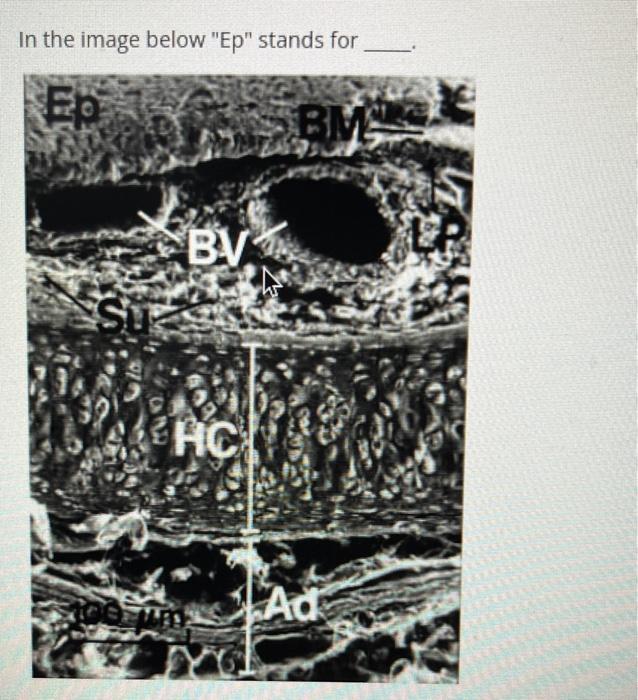 Solved In the imarra holnins "In" etande for A. Alveoli B. | Chegg.com