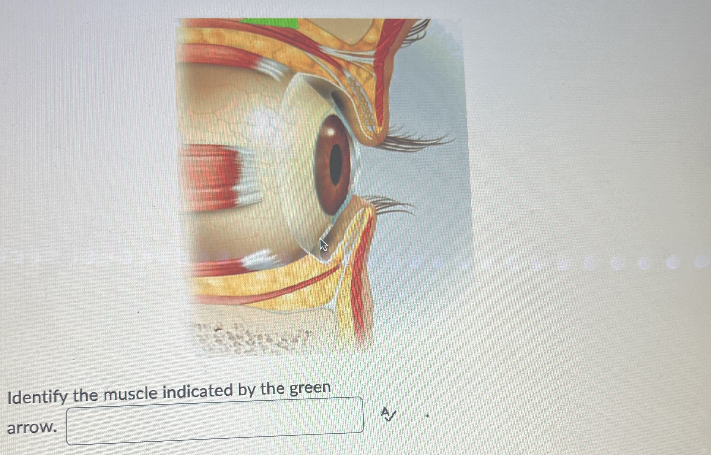 Solved Identifv the muscle indicated by the green arrow. | Chegg.com