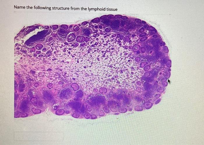 Solved Name the following structure from the lymphoid tissue | Chegg.com