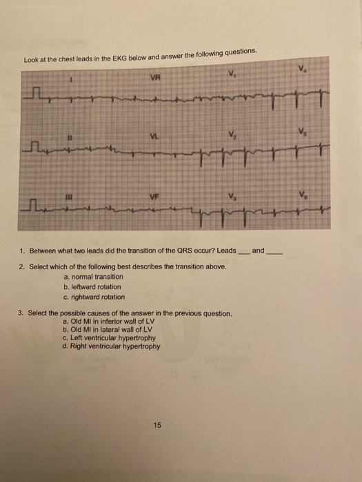 Solved Look at the chest leads in the EKG below and answer | Chegg.com