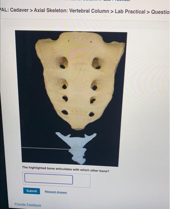 Solved AL: Cadaver > Axial Skeleton: Vertebral Column > Lab | Chegg.com
