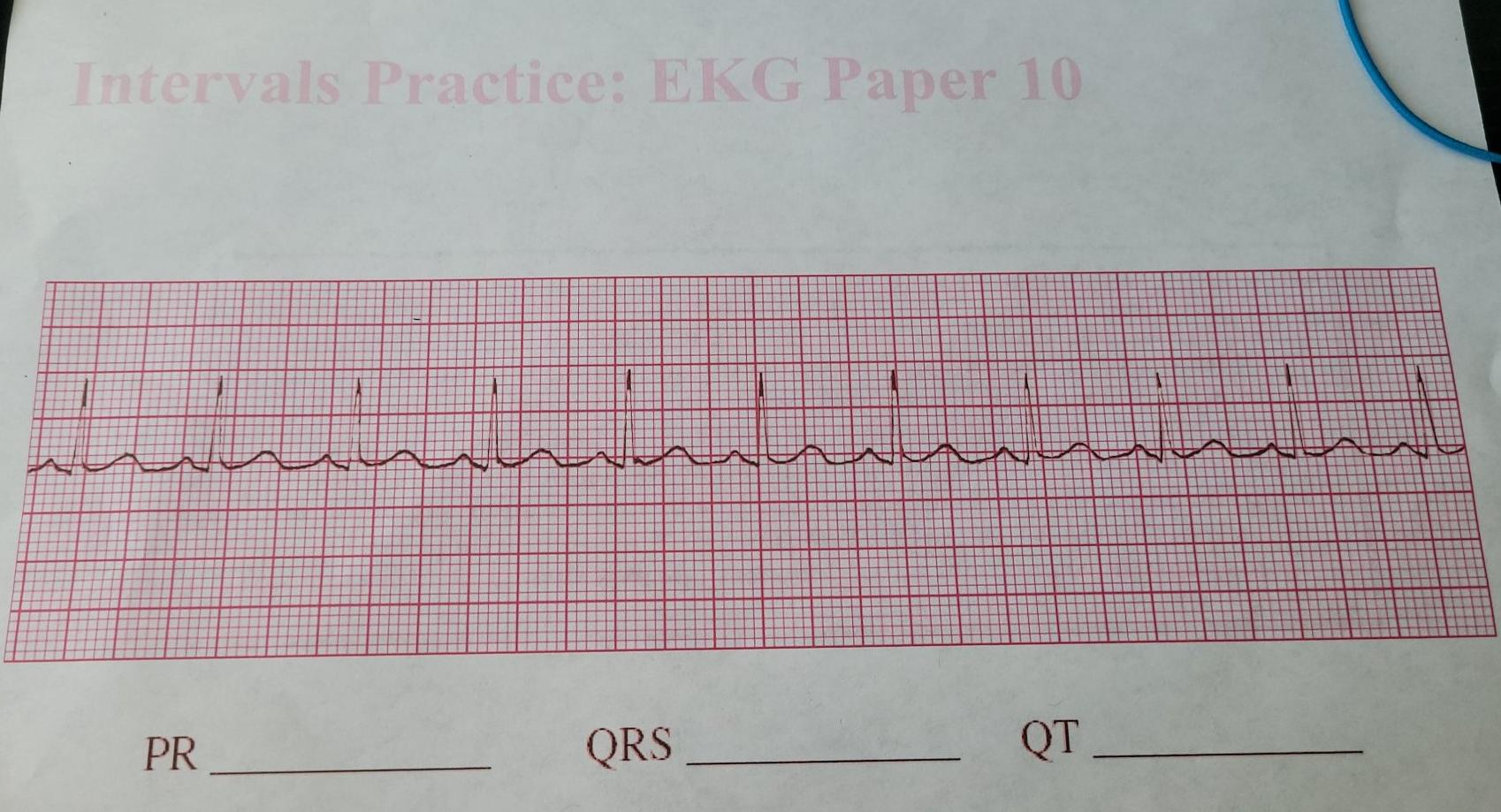 Solved Intervals Practice: EKG Paper 9 Wha PR QRS QT | Chegg.com