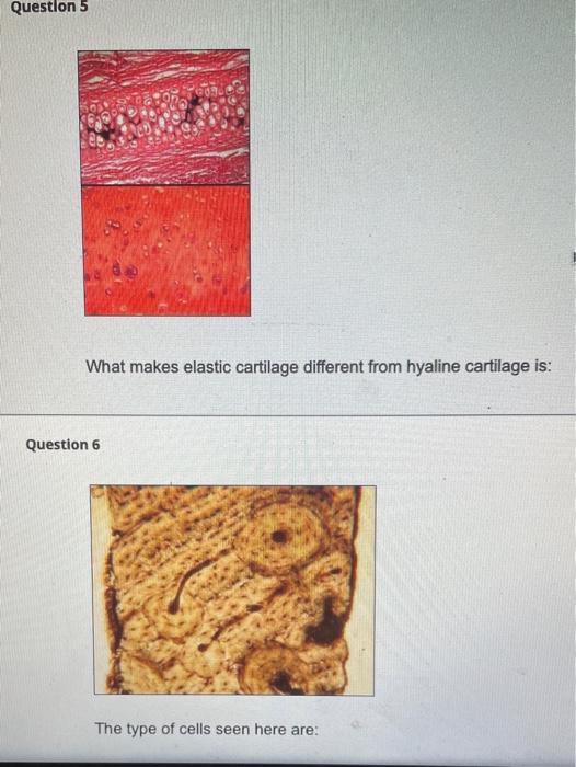 Solved Question 1 What type of tissue is seen here? Question | Chegg.com
