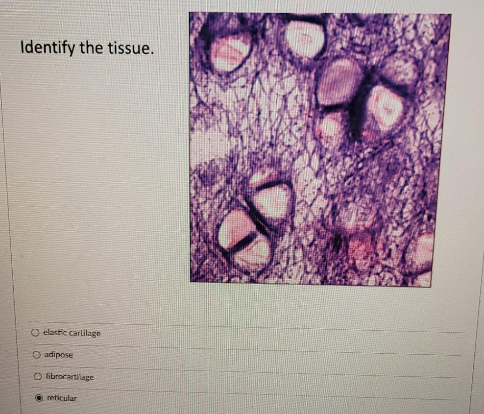 Solved Identify the tissue. elastic cartilage O adipose | Chegg.com