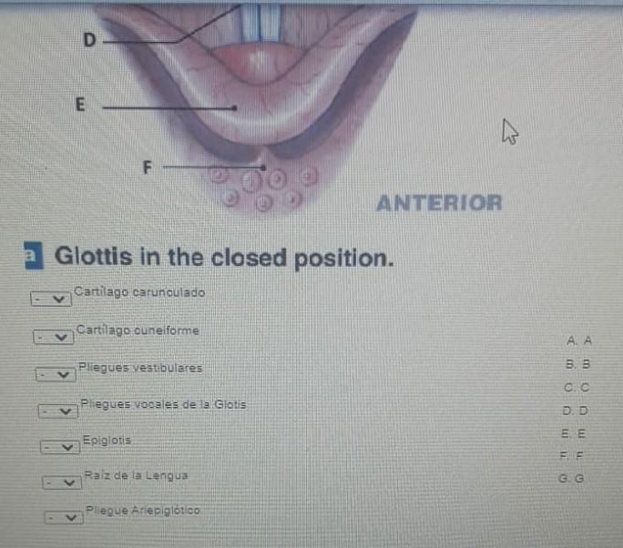 Solved D E F ANTERIOR a Glottis in the closed position. | Chegg.com