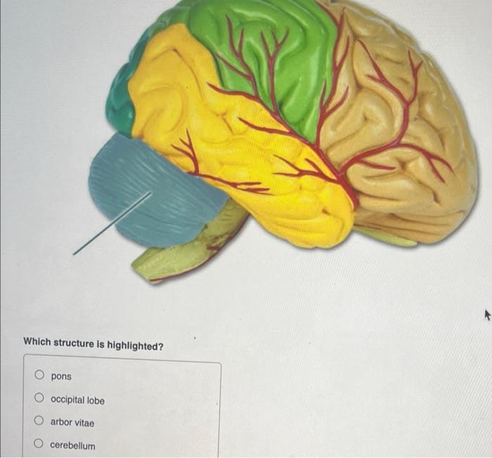 Solved Which structure is highlighted? optic nerve O | Chegg.com