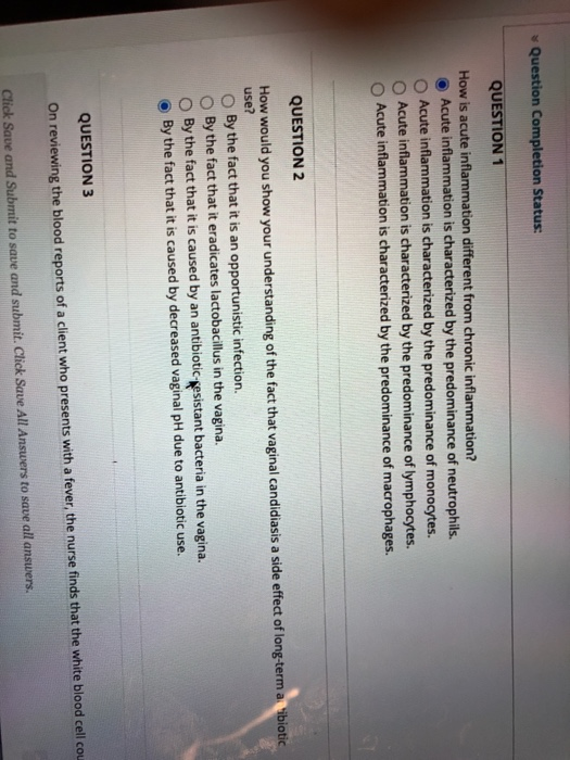 Solved Question Completion Status: QUESTION 1 How is acute | Chegg.com