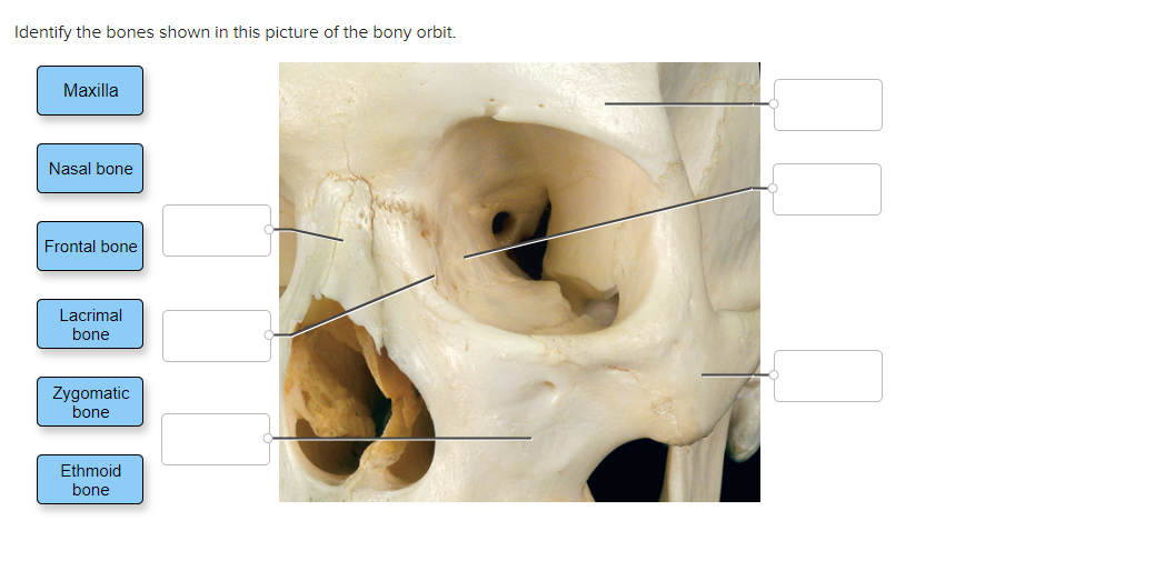 Solved Identify the bones shown in this picture of the bony | Chegg.com