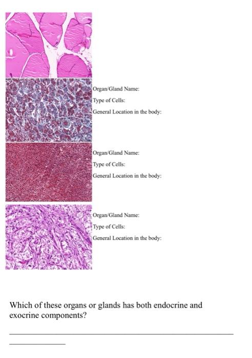 Solved First name, Last name: ID: Homework 14: Endocrine | Chegg.com