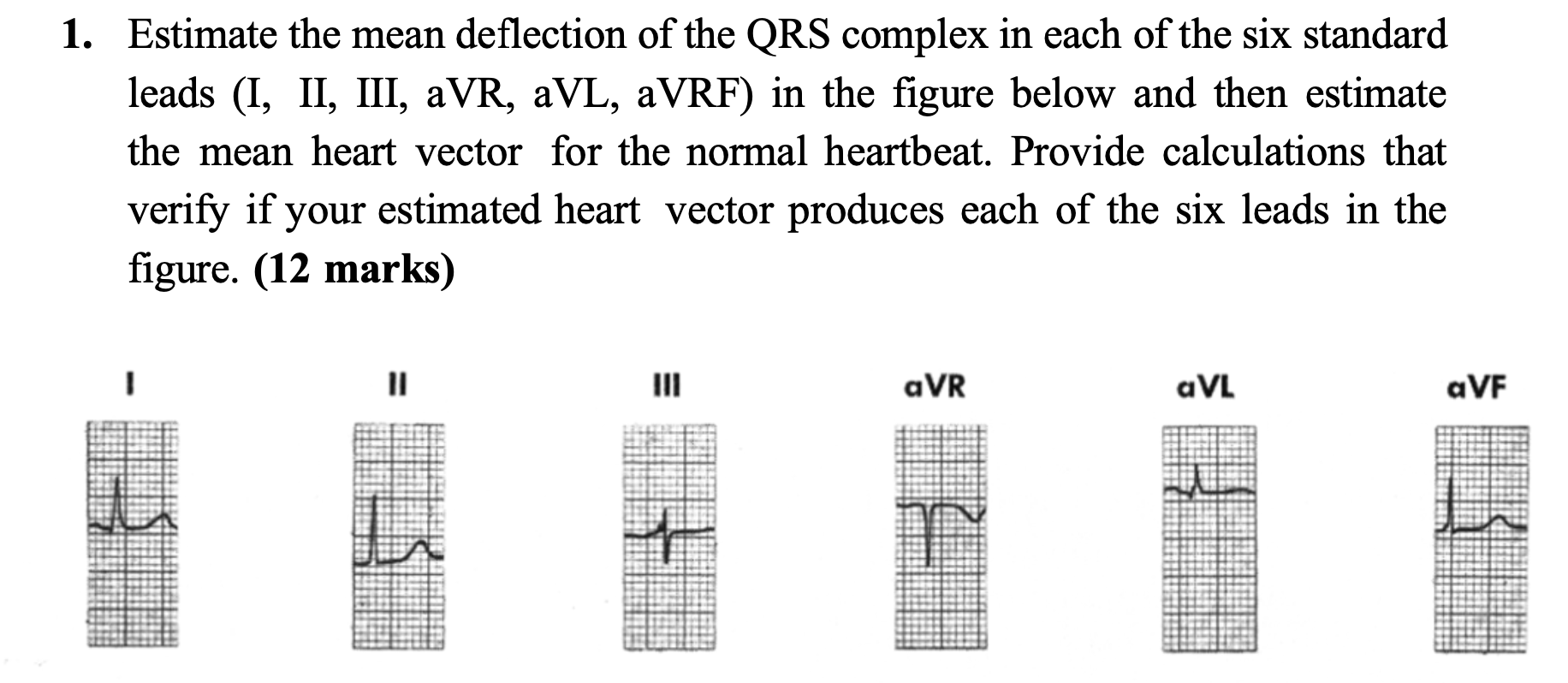 Solved Estimate the mean deflection of the QRS ﻿complex in | Chegg.com