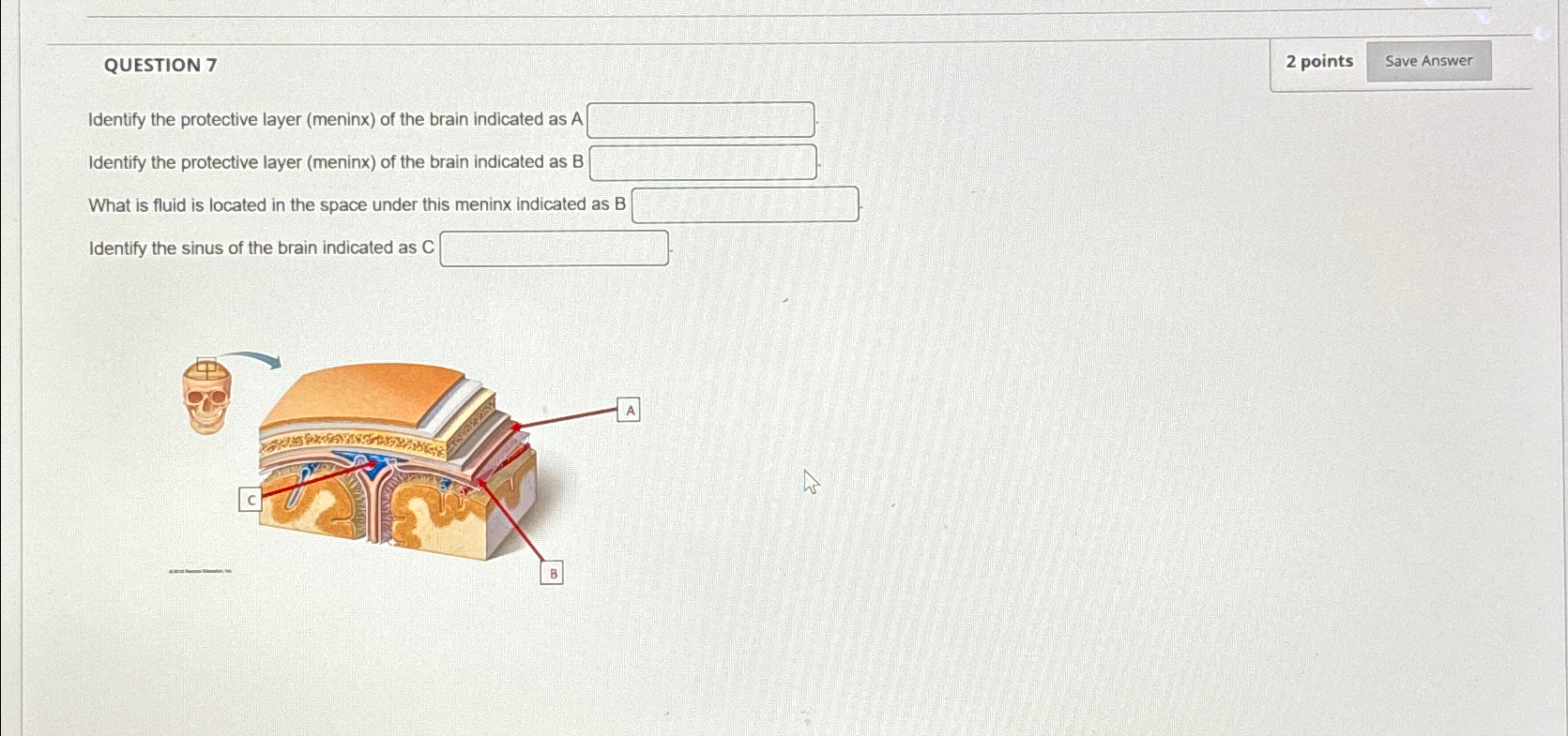 Solved QUESTION 7Identify the protective layer (meninx) ﻿of | Chegg.com