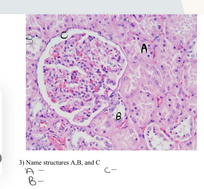 Solved 3) Name structures A,B, and C A−C−B− | Chegg.com