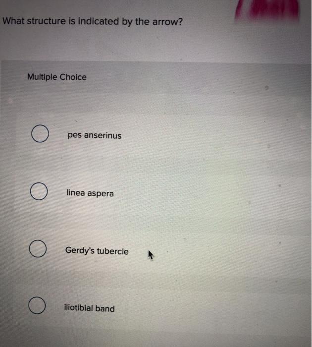 Solved What structure is indicated by the arrow? What | Chegg.com