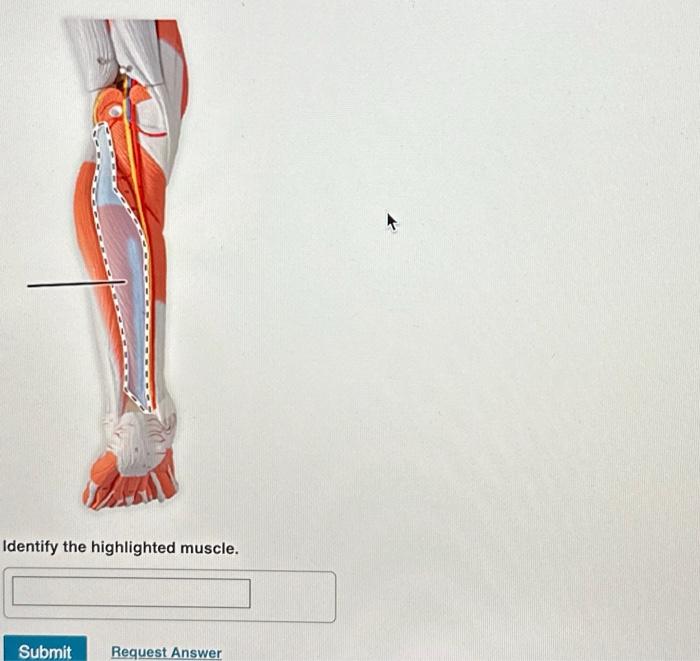Solved Identify the highlighted muscle. | Chegg.com