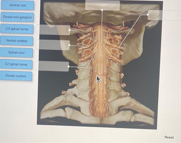 Solved Ventral root Dorsal root ganglion C3 spinal nerve | Chegg.com