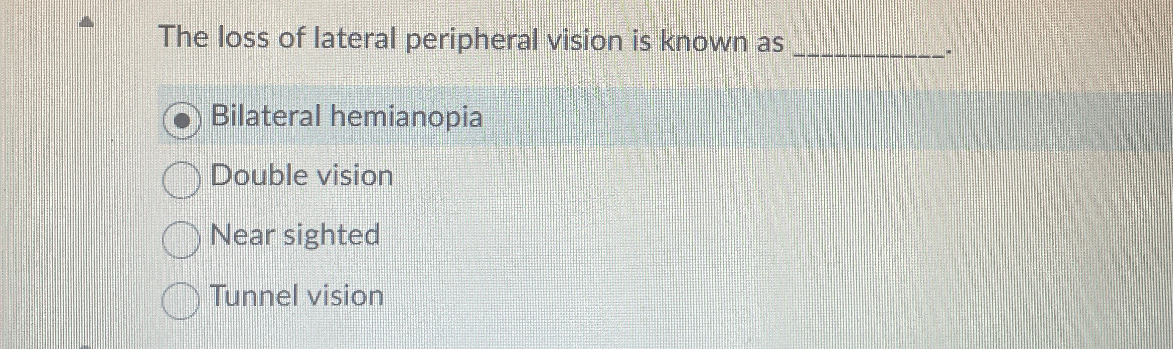 Solved The loss of lateral peripheral vision is known as | Chegg.com