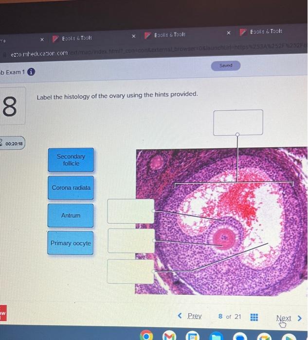 Solved Label the histology of the ovary using the hints | Chegg.com