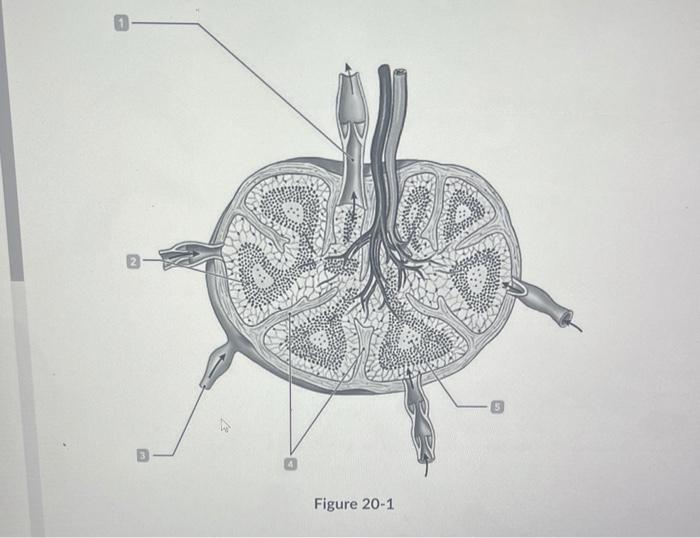 Solved Figure 20-1 Identify the dominant cell type in the | Chegg.com