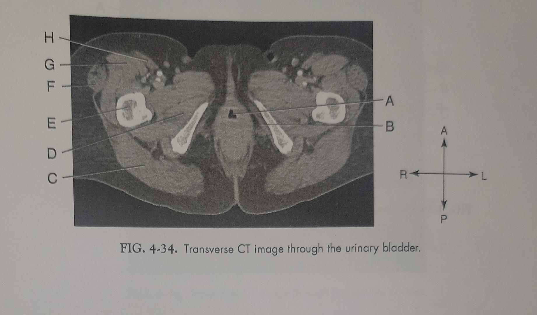 Solved Fig 4 34 Transverse Ct Image Through The Urinary
