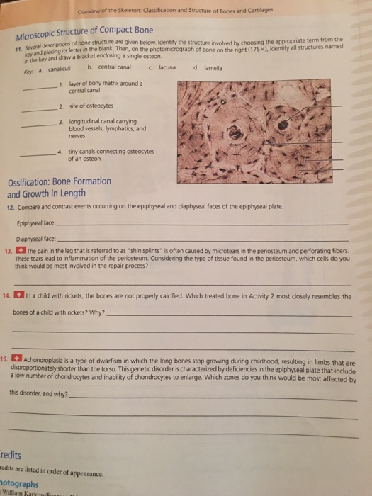 solved-classification-of-bones-2-the-four-major-anatomical-chegg