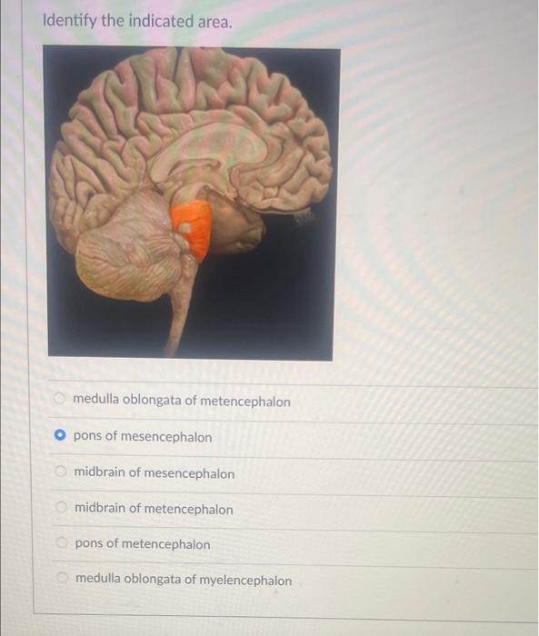 Solved Identify the indicated area. medulla oblongata of | Chegg.com
