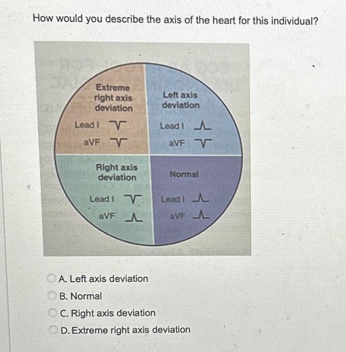 Solved aussonowi How would you describe the axis of the | Chegg.com