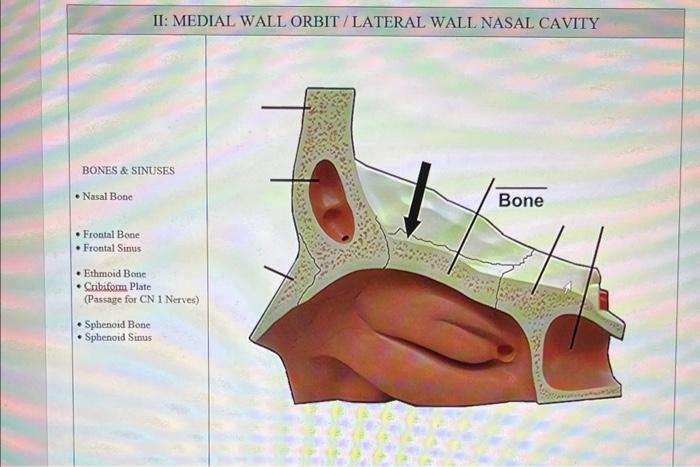 Solved medial wall orbit / lateral wall nasal cavity -label | Chegg.com