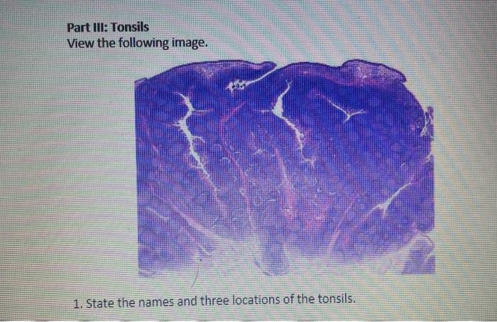 Solved Part III: Tonsils View the following image. 1. State | Chegg.com