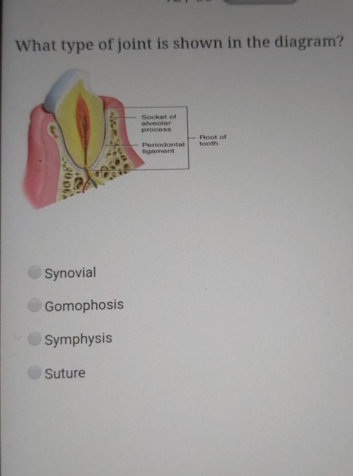 Solved What type of joint is shown in the diagram? Socket of | Chegg.com