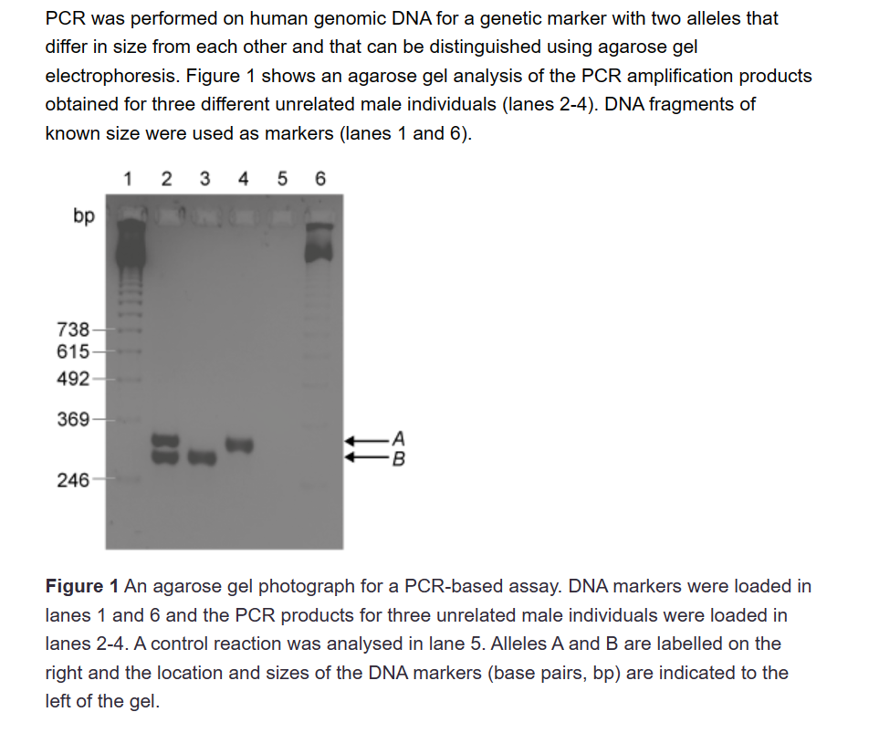 Solved PCR was performed on human genomic DNA for a genetic | Chegg.com