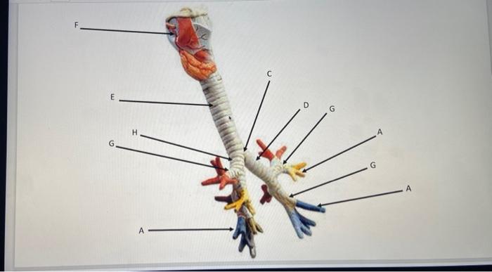 Solved Label the following: Trachea, Larynx, Left primary | Chegg.com