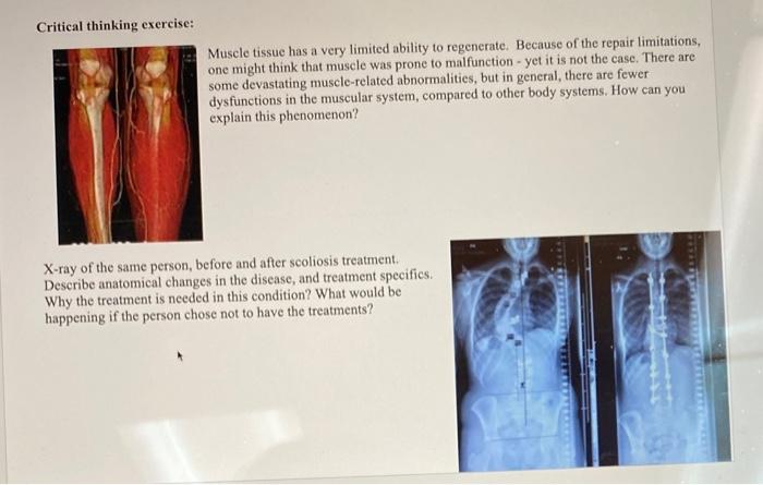 Solved Critical thinking exercise: Muscle tissue has a very | Chegg.com