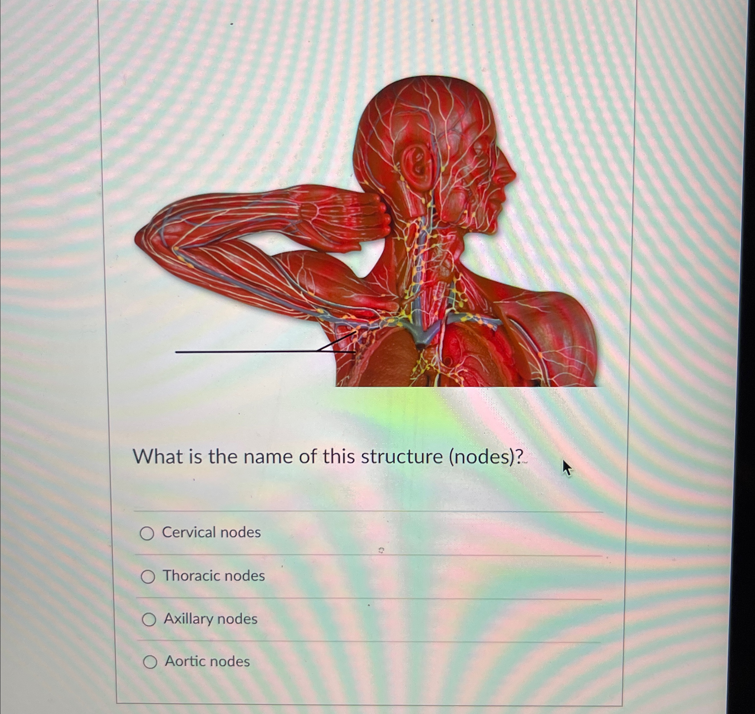 Solved What is the name of this structure (nodes)?Cervical | Chegg.com