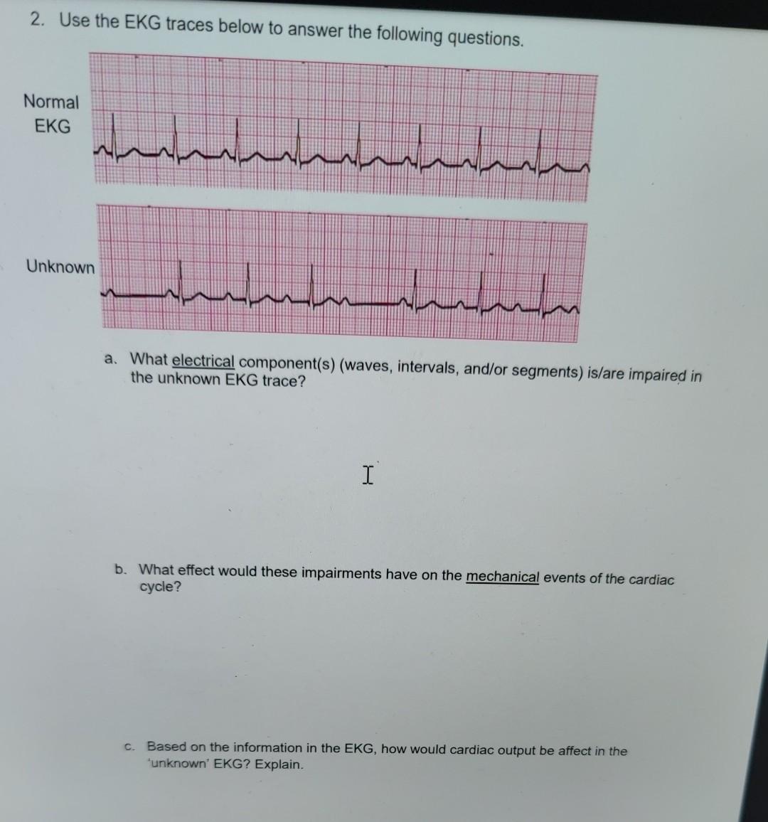 Solved the unknown EKG trace? b. What effect would these | Chegg.com