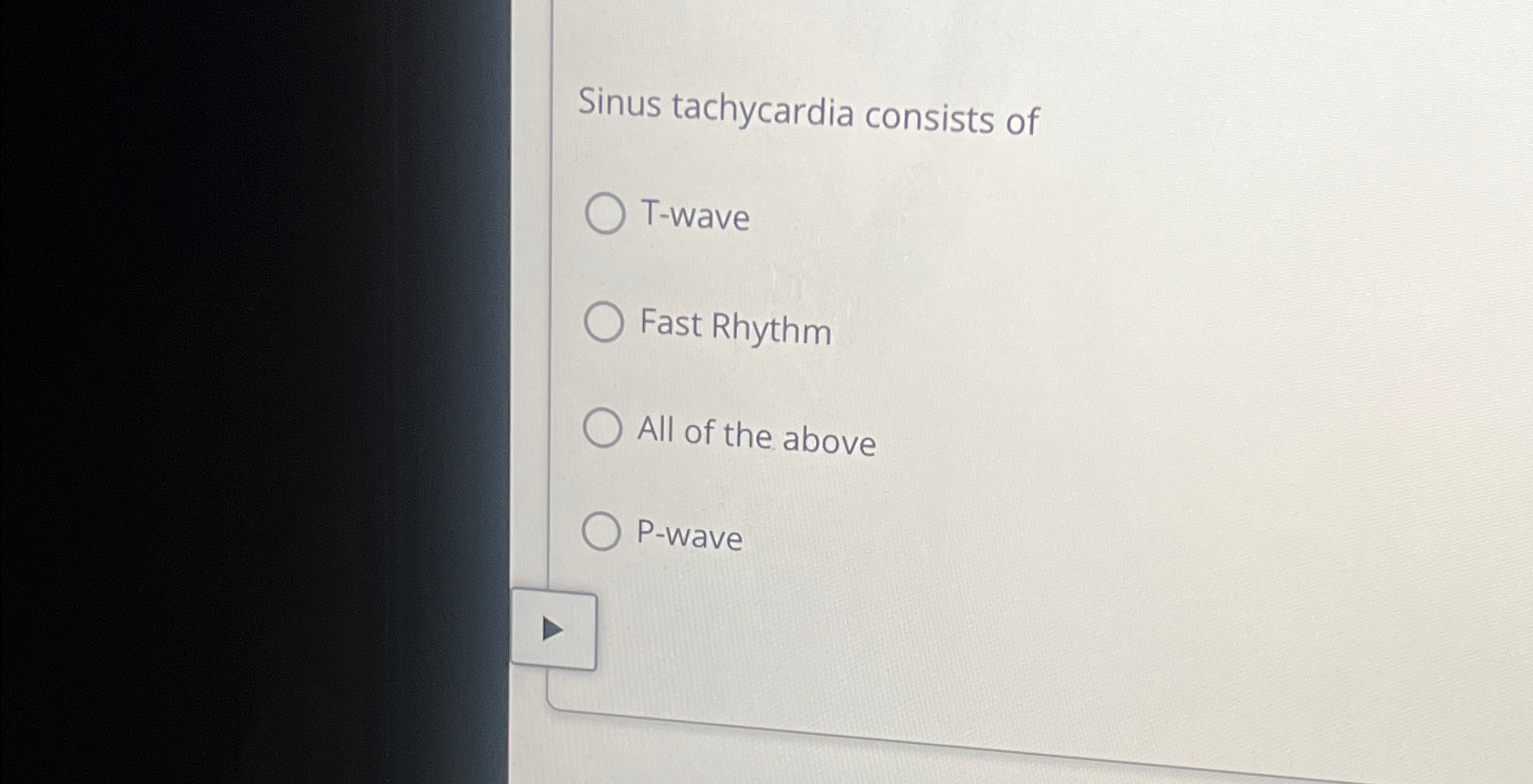 Solved Sinus Tachycardia Consists Oft Wavefast Rhythmall Of