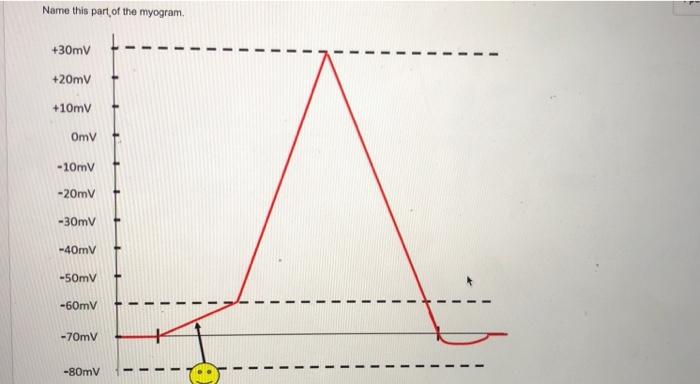 Solved Name this part of the myogram. +30mV +20mV +10mV OmV | Chegg.com