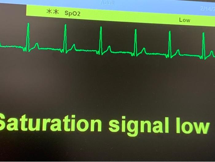 Solved e Carter Adu ** SpO2 Low _mv pumpu Saturation signal | Chegg.com