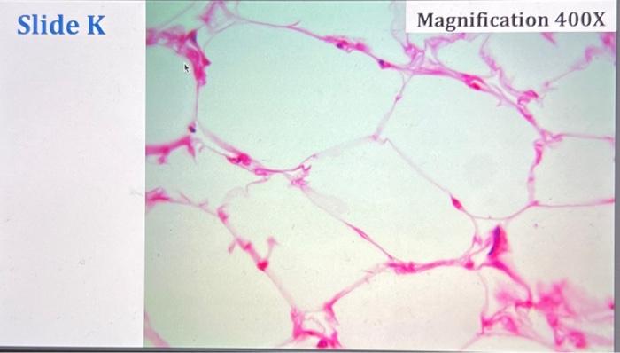 Solved Slide F Magnification 1000X Hint: this is not an | Chegg.com