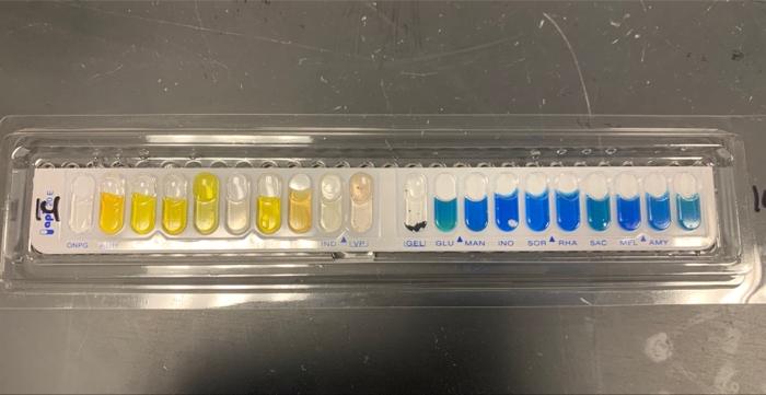 Solved b้̉ | Chegg.com