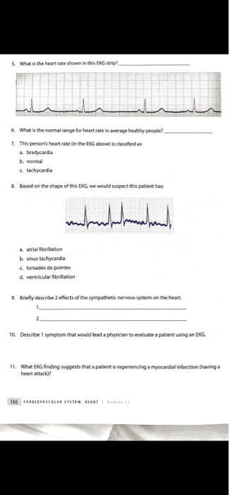 Solved EKG LAB REPORT TEAR OUT SHEET MODULE 13 1. Paste the | Chegg.com