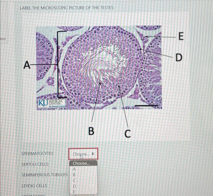 Solved LABEL THE MICROSCOPIC PICTURE OF THE TESTES: E Lion D | Chegg.com