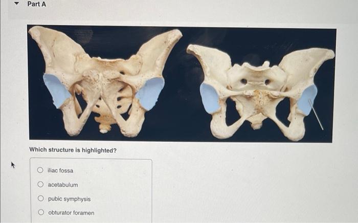 Solved Part A Which structure is highlighted? iliac fossa | Chegg.com