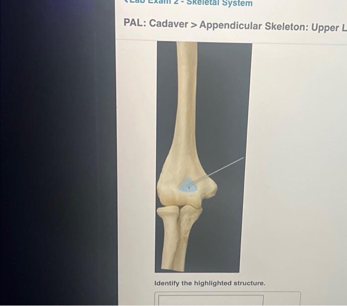 Solved System PAL: Cadaver > Appendicular Skeleton: Upper L | Chegg.com