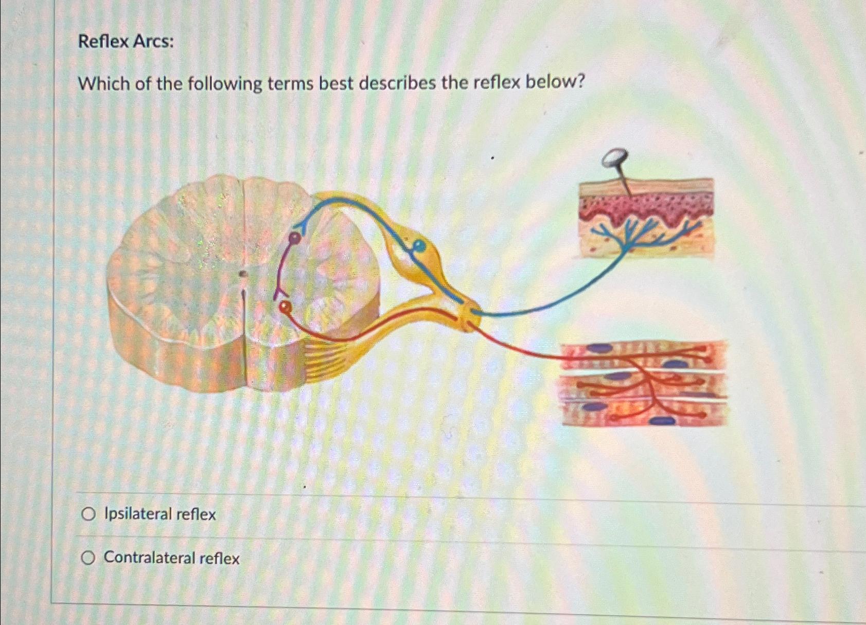 Solved Reflex Arcs:Which of the following terms best | Chegg.com