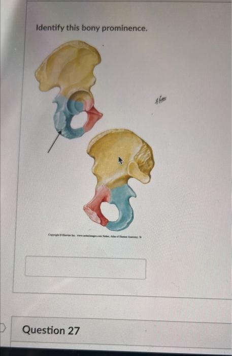 Solved Identify this bony prominence. Cepe Question 27 | Chegg.com