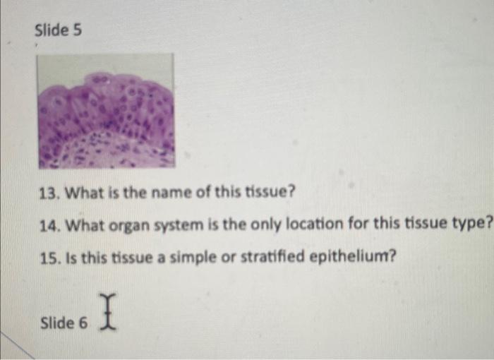 Solved Slide 5 13. What is the name of this tissue? 14. What | Chegg.com