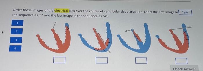 Solved Order these images of the electrical axis over the | Chegg.com