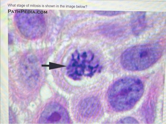 Solved What stage of mitosis is shown in the image below? | Chegg.com